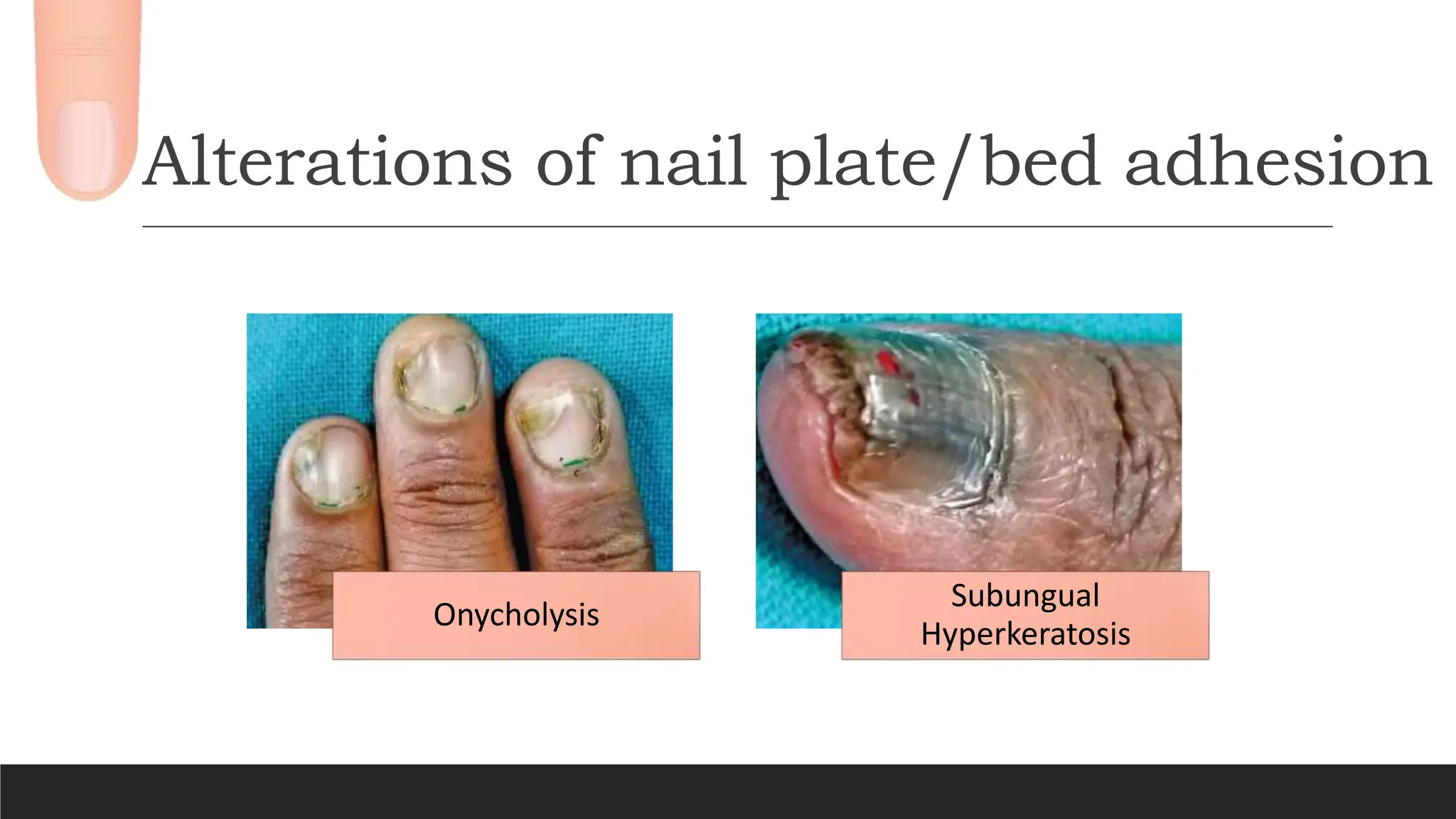 Structure of Nail | PPTX