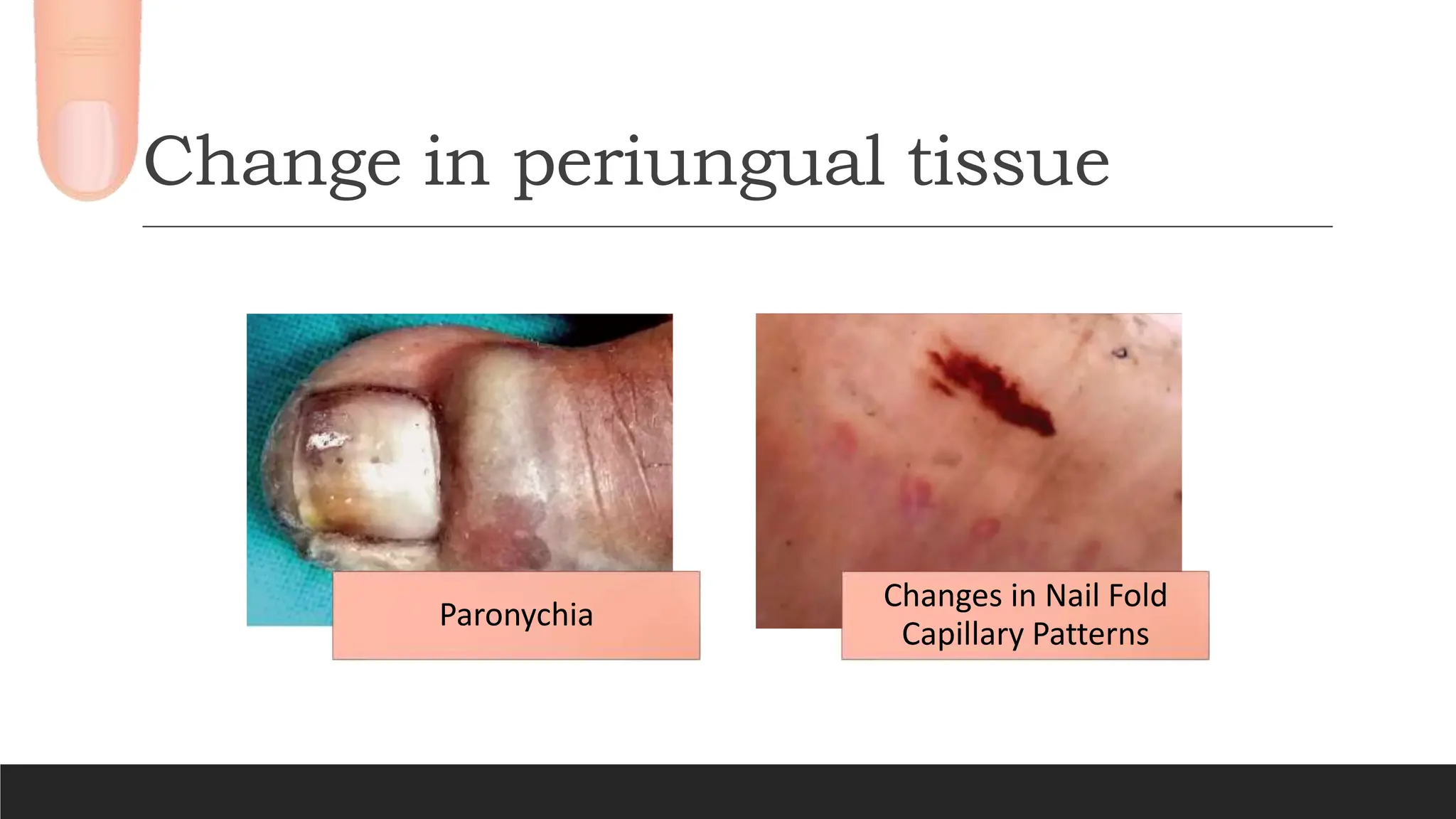 Structure of Nail | PPTX