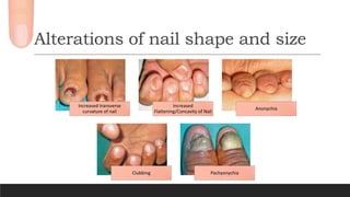 Structure of Nail | PPTX