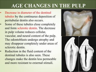 Structure and function of of Pulp-Dentin complex | PPTX