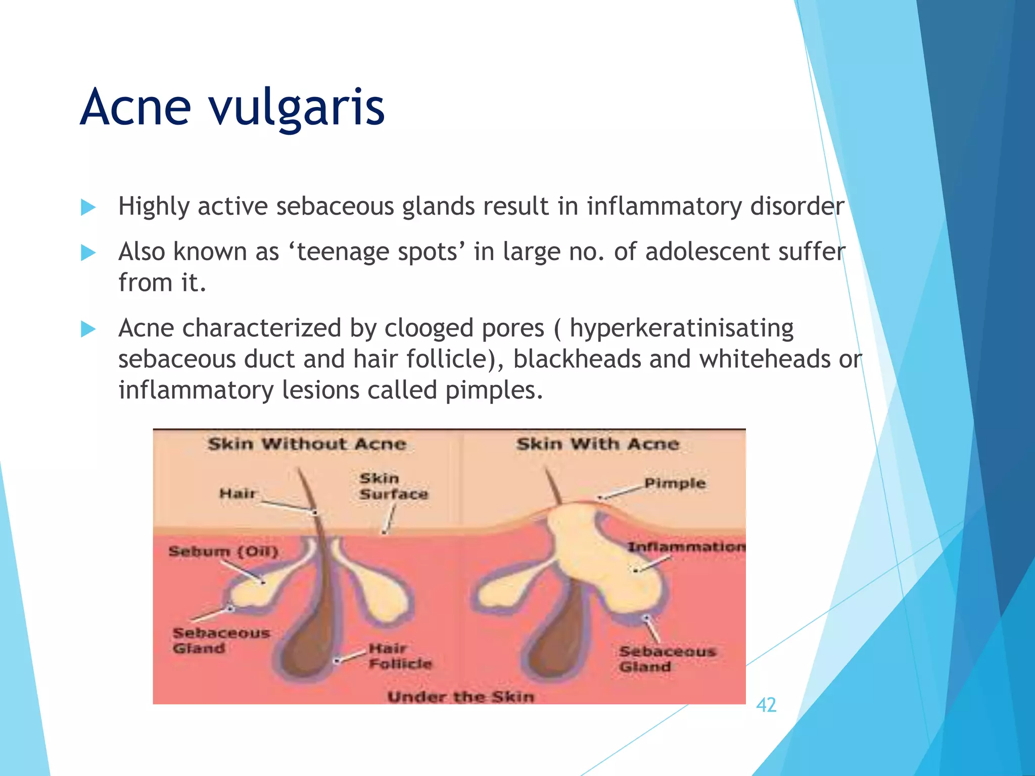 Structure of skin, Dry Skin and Acne | PPTX