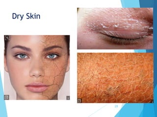 Structure of skin, Dry Skin and Acne | PPTX