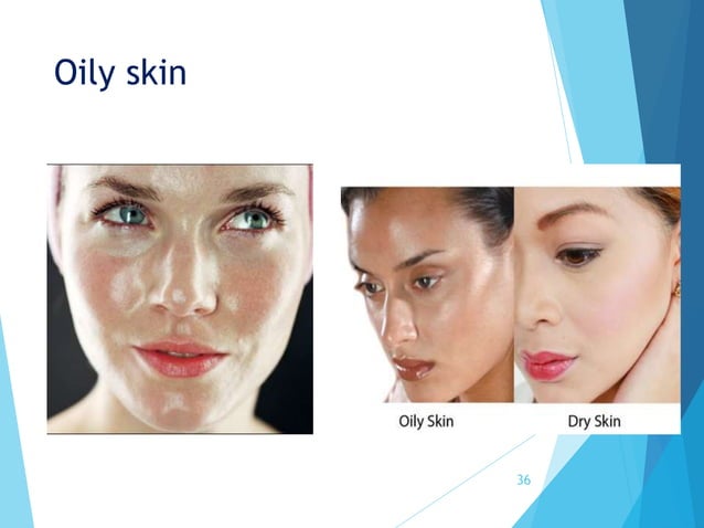 Structure of skin, Dry Skin and Acne | PPTX | Skin and Dermatology ...