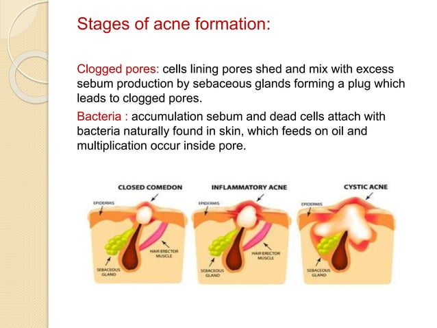 Structure of skin and skin relating problems | PPTX