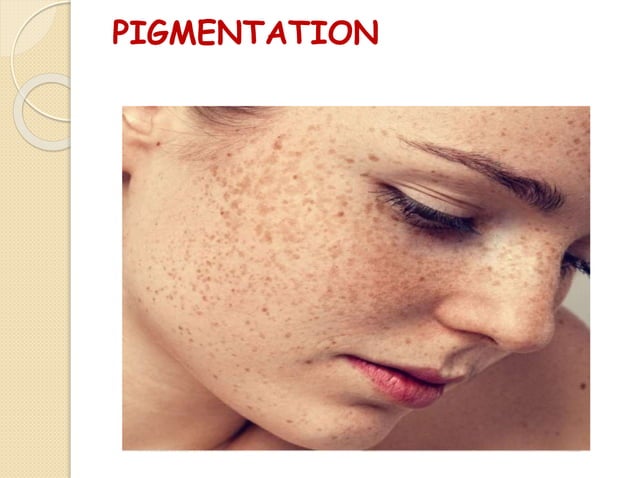 Structure of skin and skin relating problems | PPTX