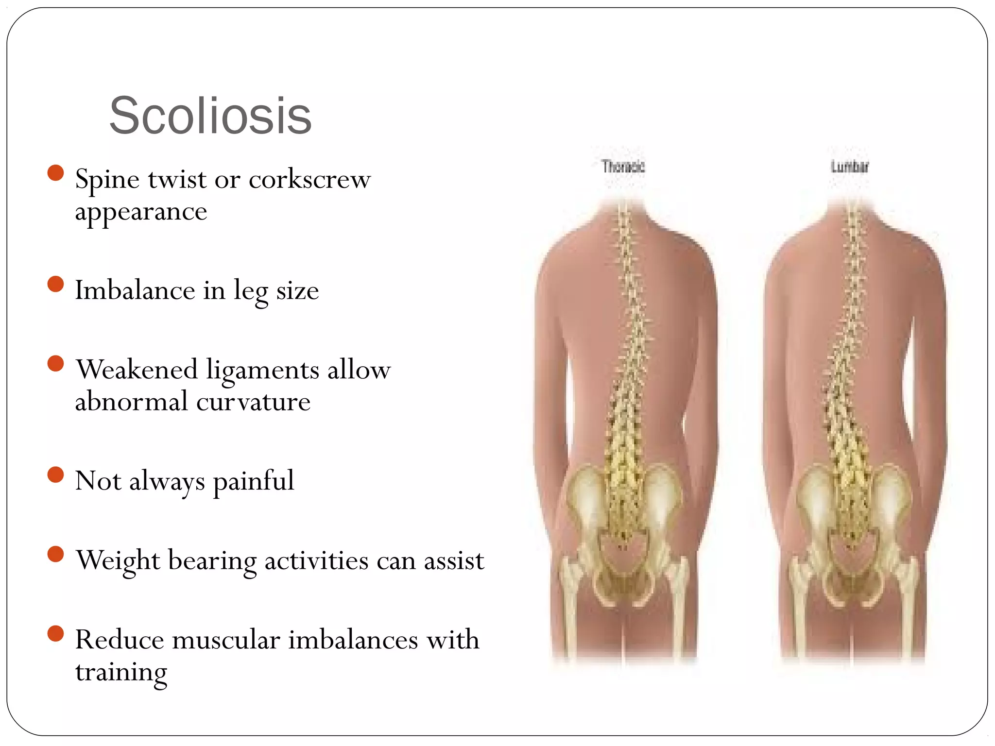 Structure of spine and vertebrae | PPT