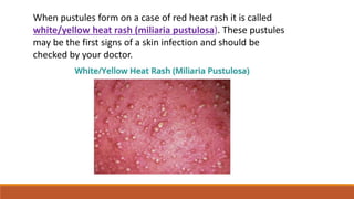 Structures of skin having different problems | PPTX