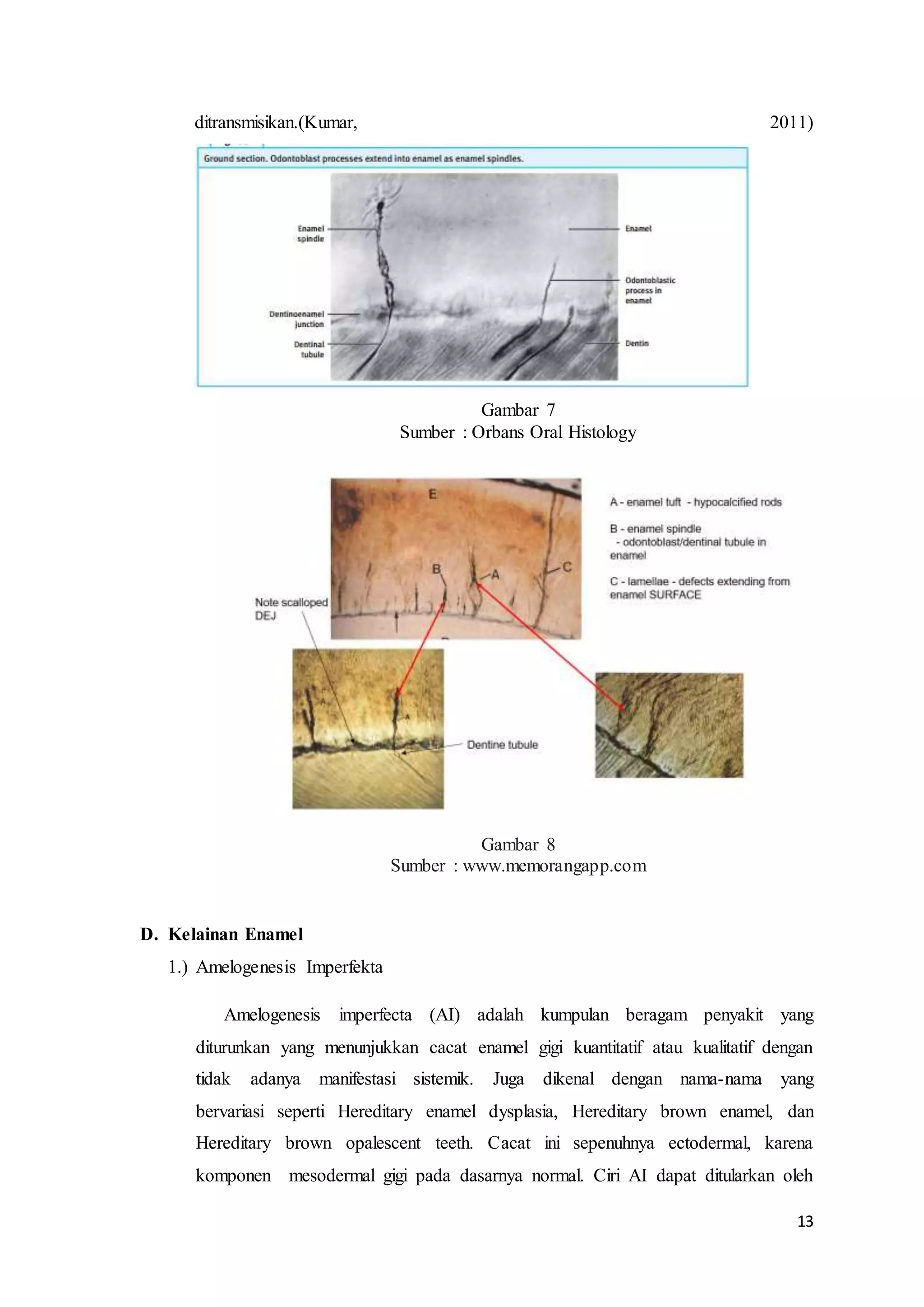 Struktur dan kelainan enamel | DOCX