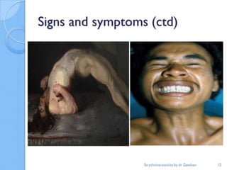 Strychinine poisoning (Nux vomica) / Rodenticide/ tetanus/ spinal ...