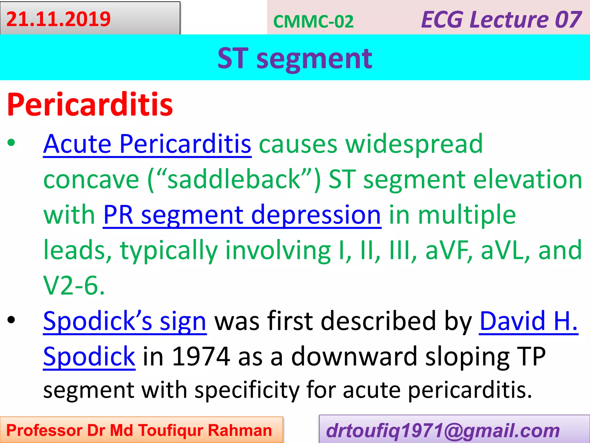 ECG- ST segment | PPSX