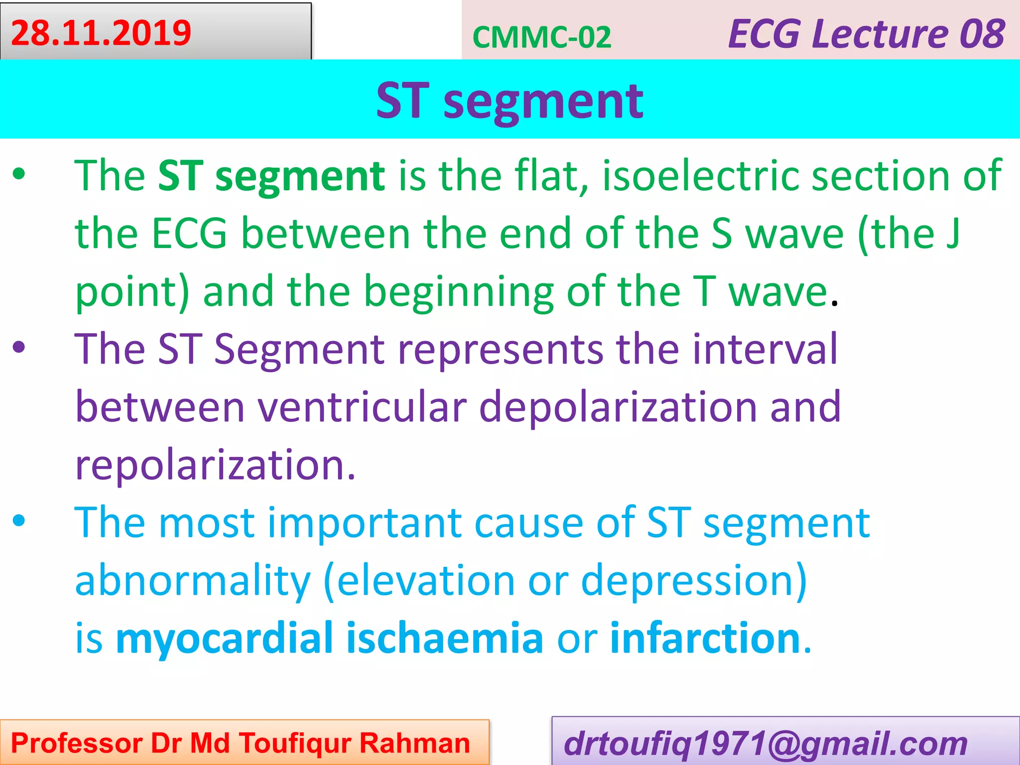 ECG- ST segment | PPSX