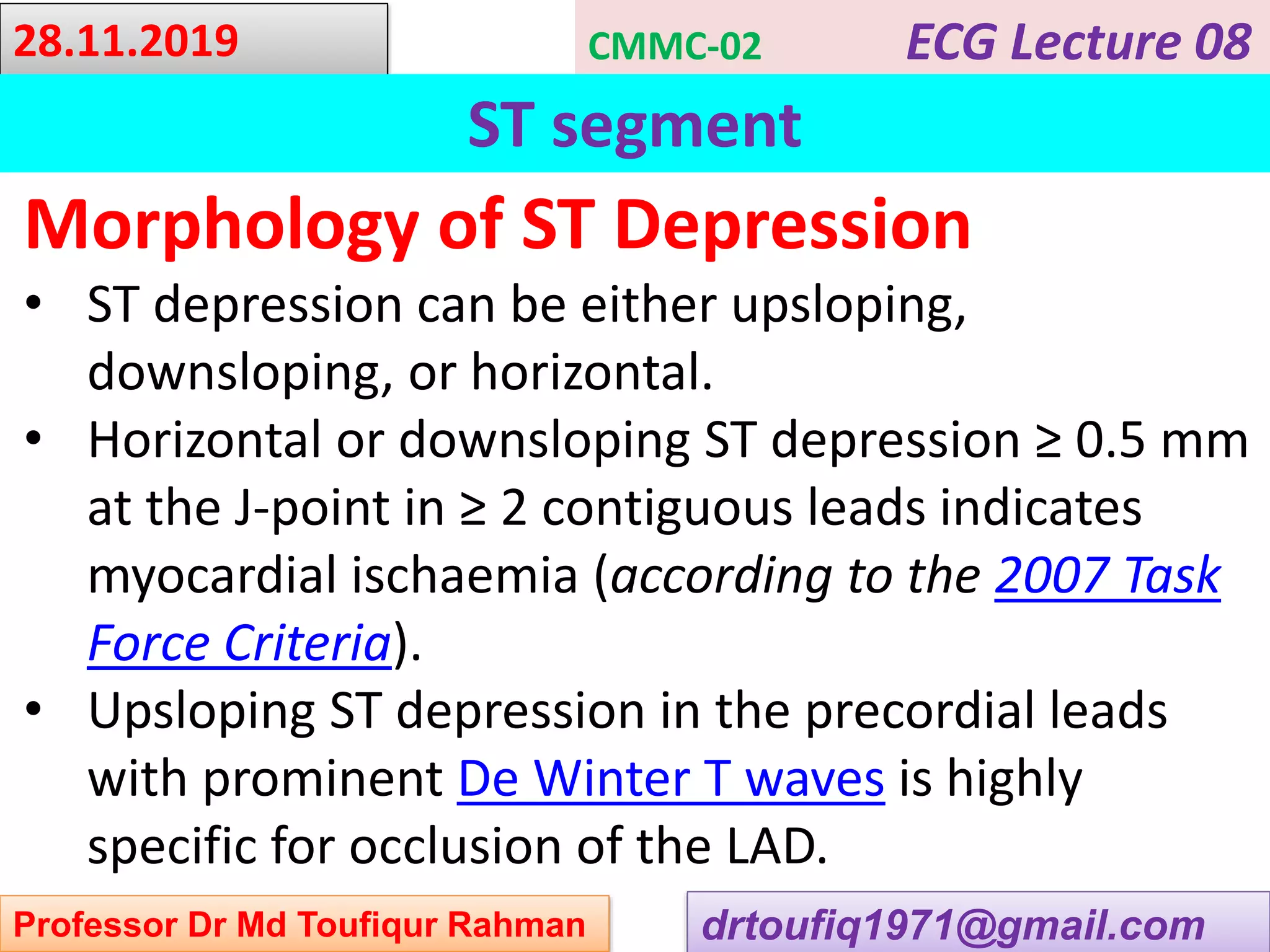 ECG- ST segment | PPSX