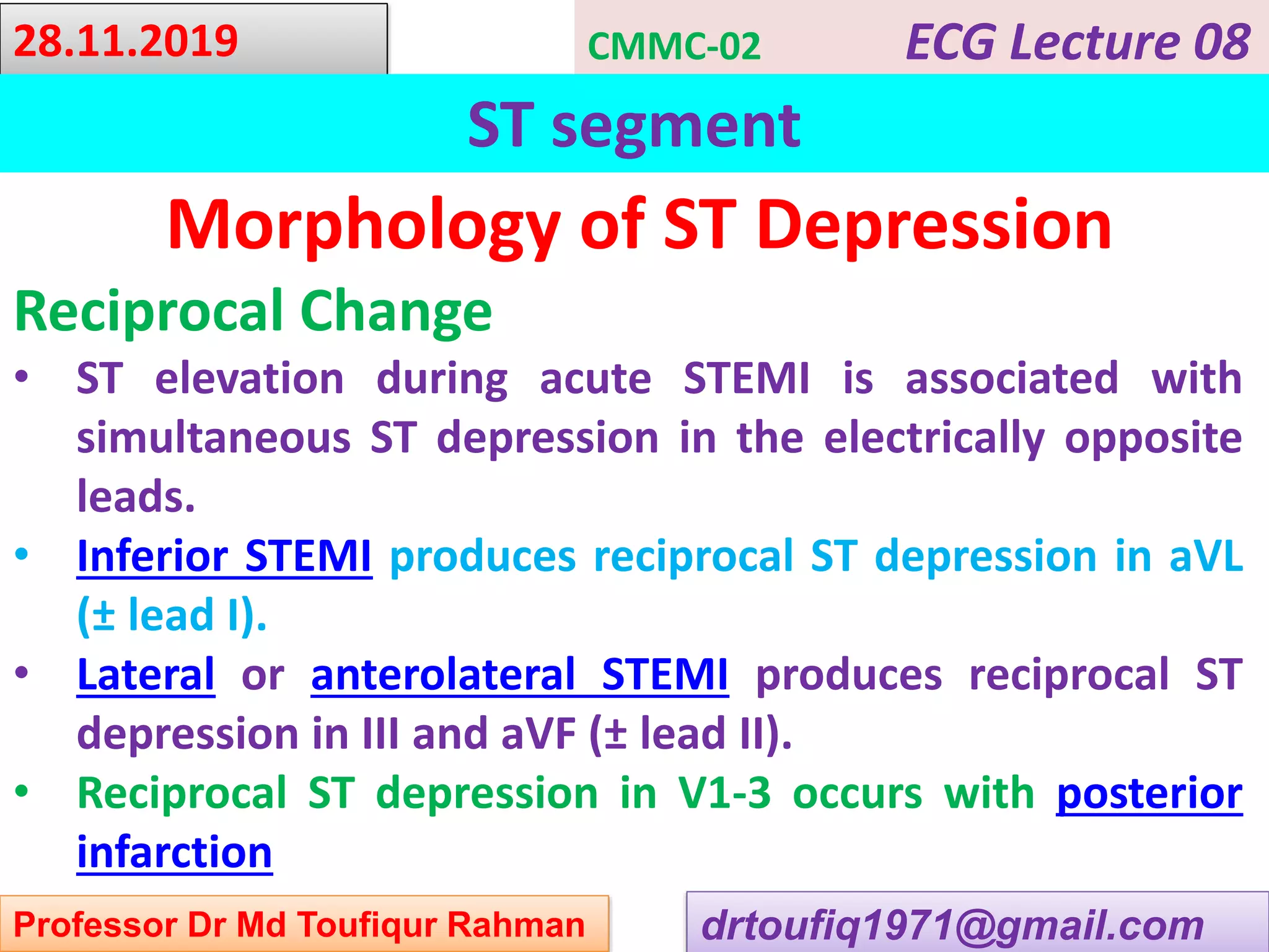 ECG- ST segment | PPSX