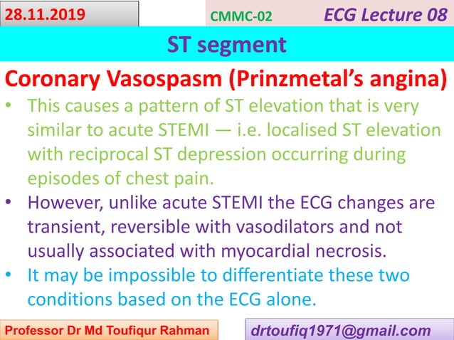 ECG- ST segment | PPSX