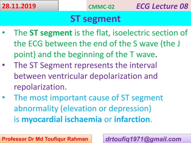ECG- ST segment | PPSX