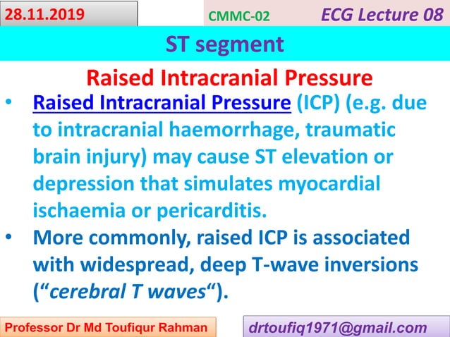 ECG- ST segment | PPSX