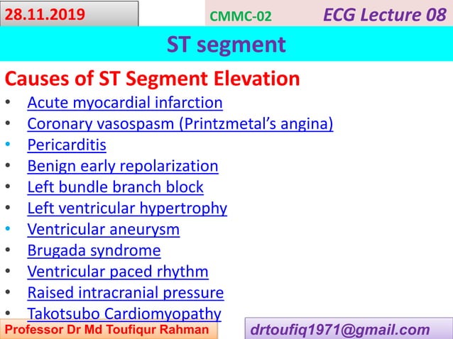 ECG- ST segment | PPSX