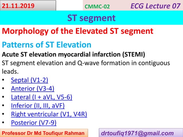 ECG- ST segment | PPSX