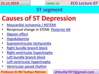 St Segment Depression