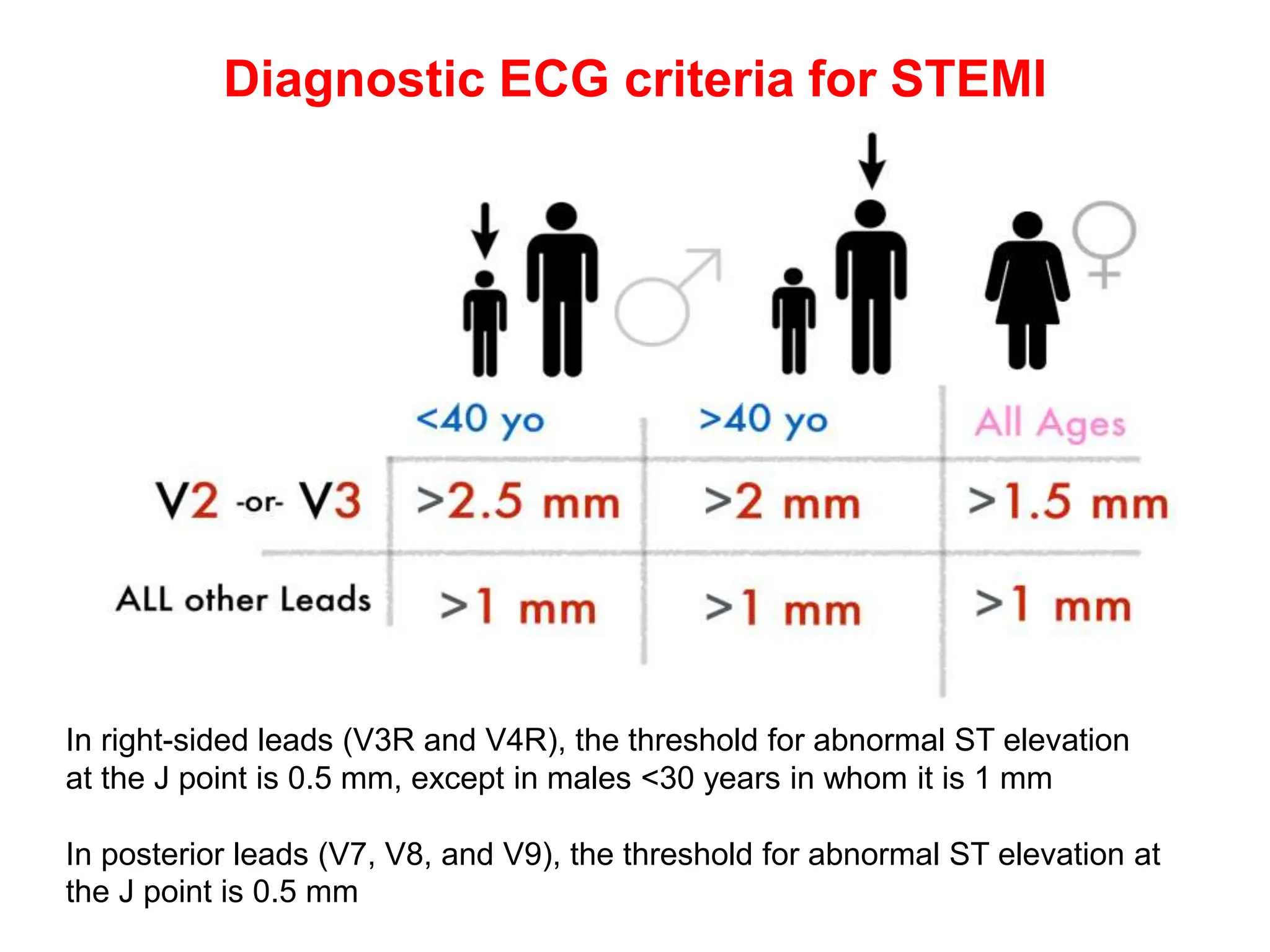 ST SEGMENT IN ECG,ST ELEVATION AND ST DEPRESSION | PPTX