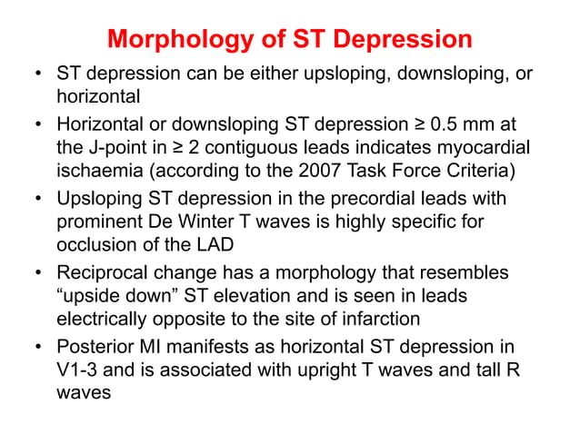 ST SEGMENT IN ECG,ST ELEVATION AND ST DEPRESSION | PPTX