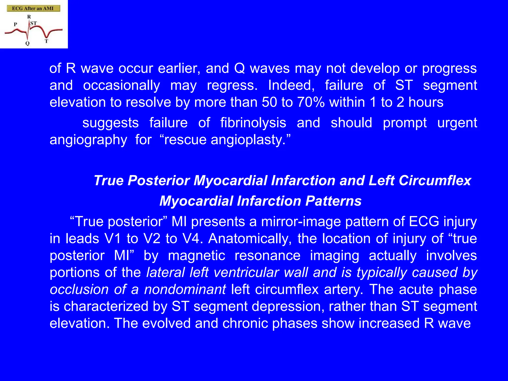 St Segment Elevation Acute Myocardial Infarction And Complications Of