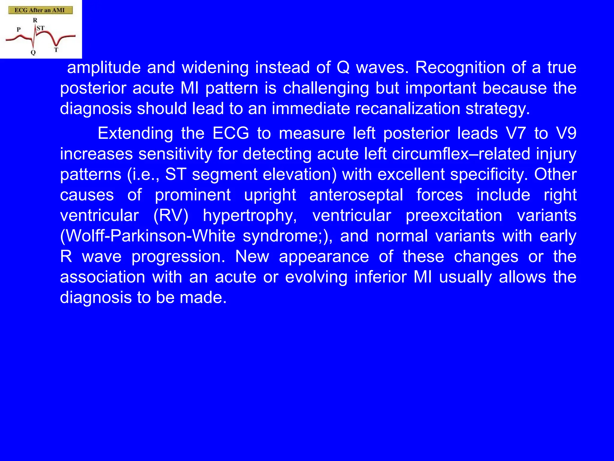 St Segment Elevation Acute Myocardial Infarction And Complications Of