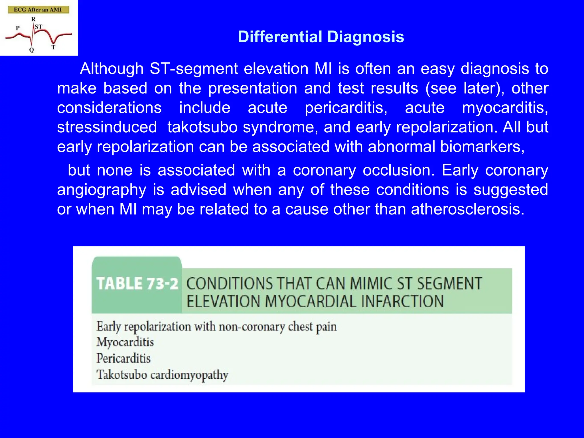 St Segment Elevation Acute Myocardial Infarction And Complications Of
