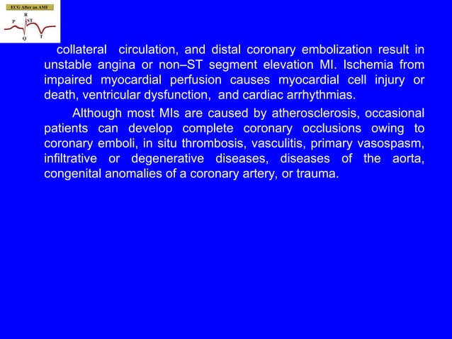 St Segment Elevation Acute Myocardial Infarction And Complications Of