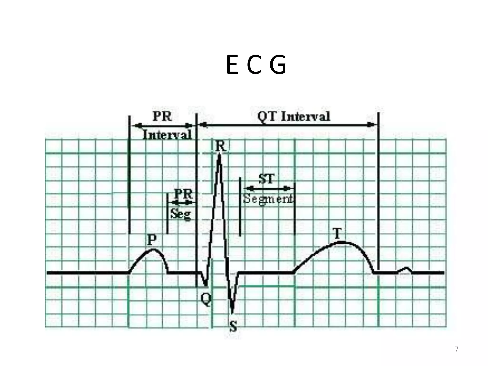 St segment elevations | PPTX