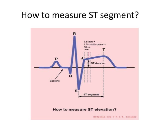 St segment elevations
