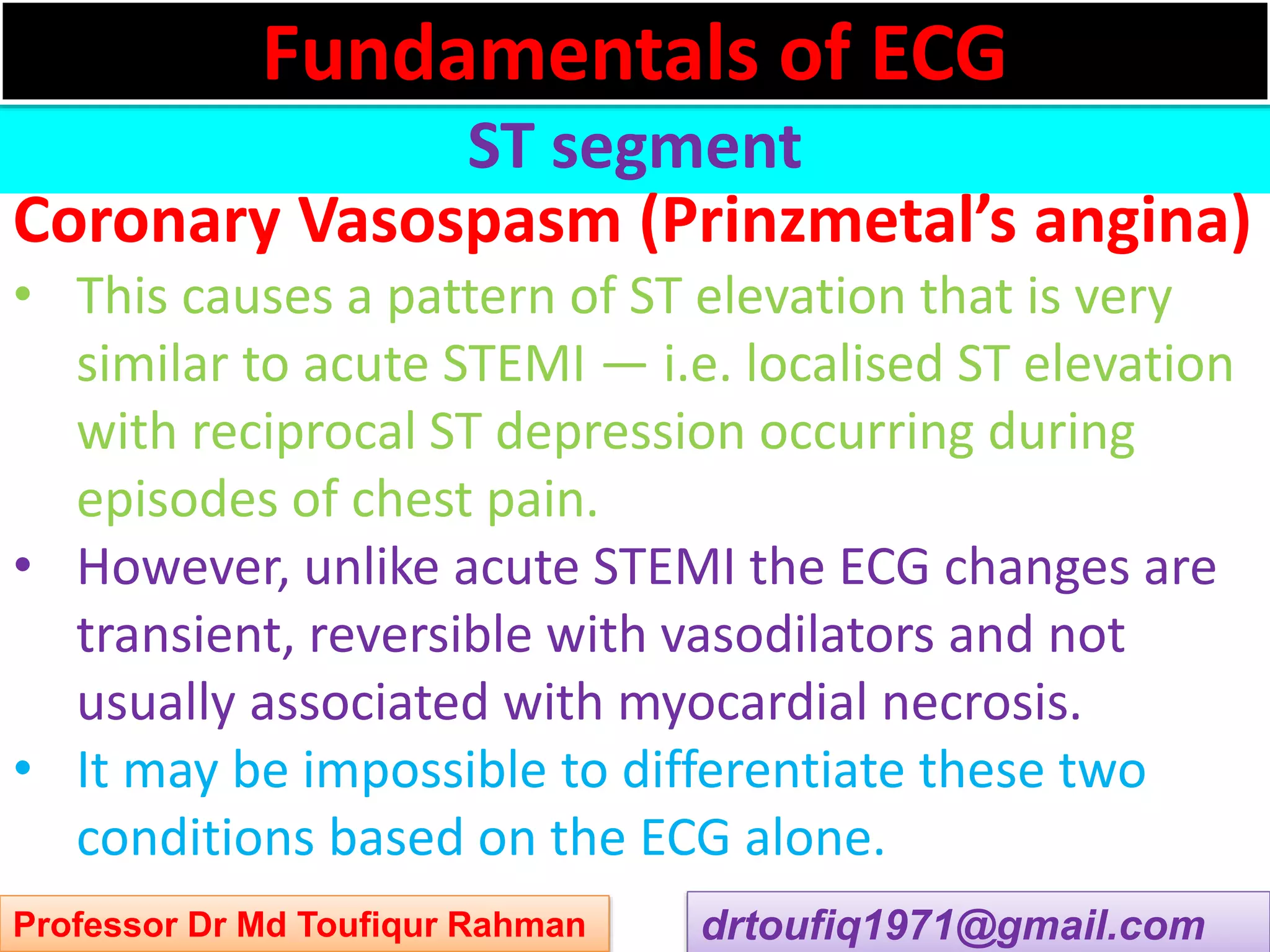 Approach to a patient with ST segment abnormality in ECG | PPT