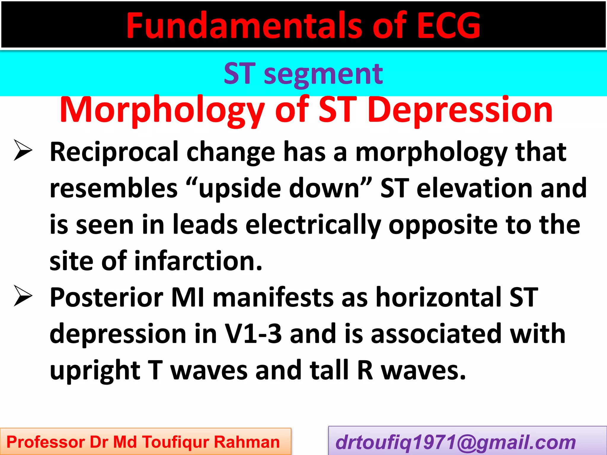 Approach to a patient with ST segment abnormality in ECG | PPT