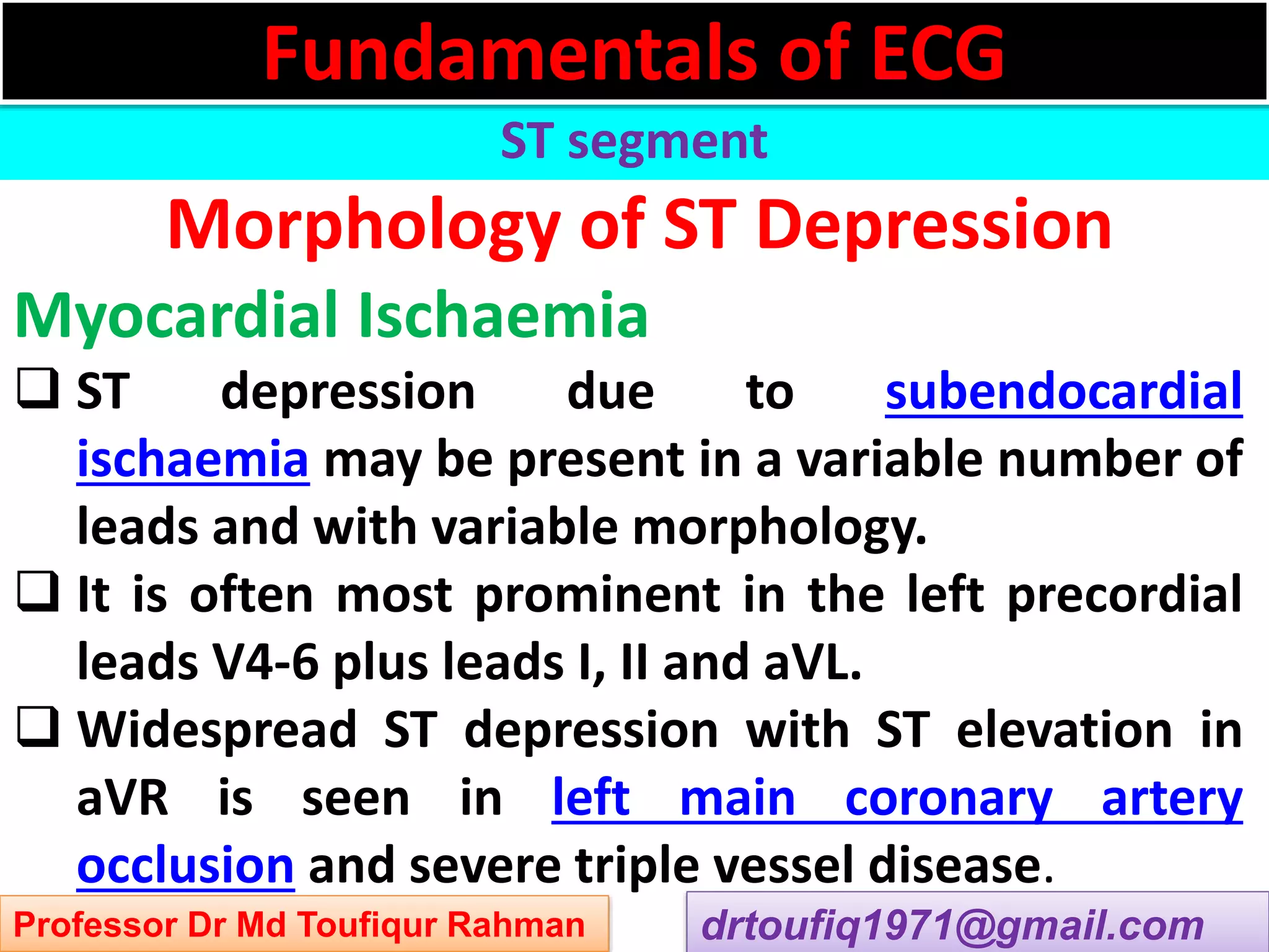 Approach to a patient with ST segment abnormality in ECG | PPT