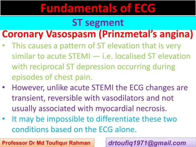 Approach to a patient with ST segment abnormality in ECG | PPT
