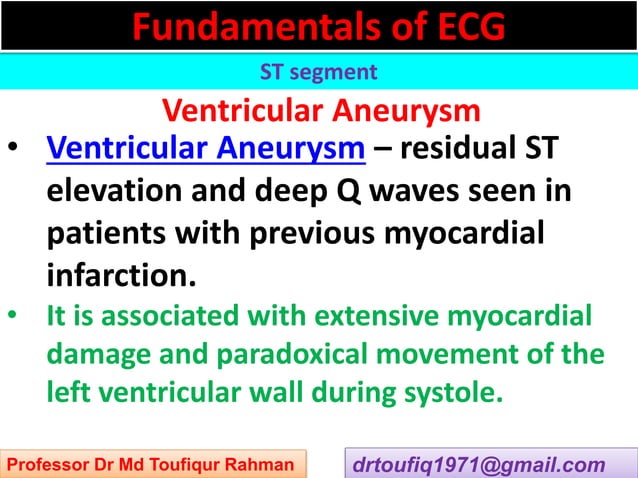 Approach to a patient with ST segment abnormality in ECG | PPT