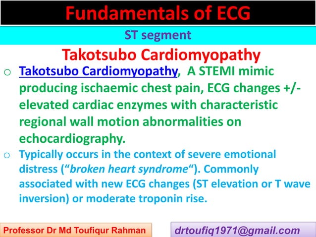 Approach to a patient with ST segment abnormality in ECG | PPT