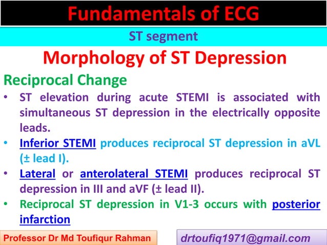 Approach to a patient with ST segment abnormality in ECG | PPT