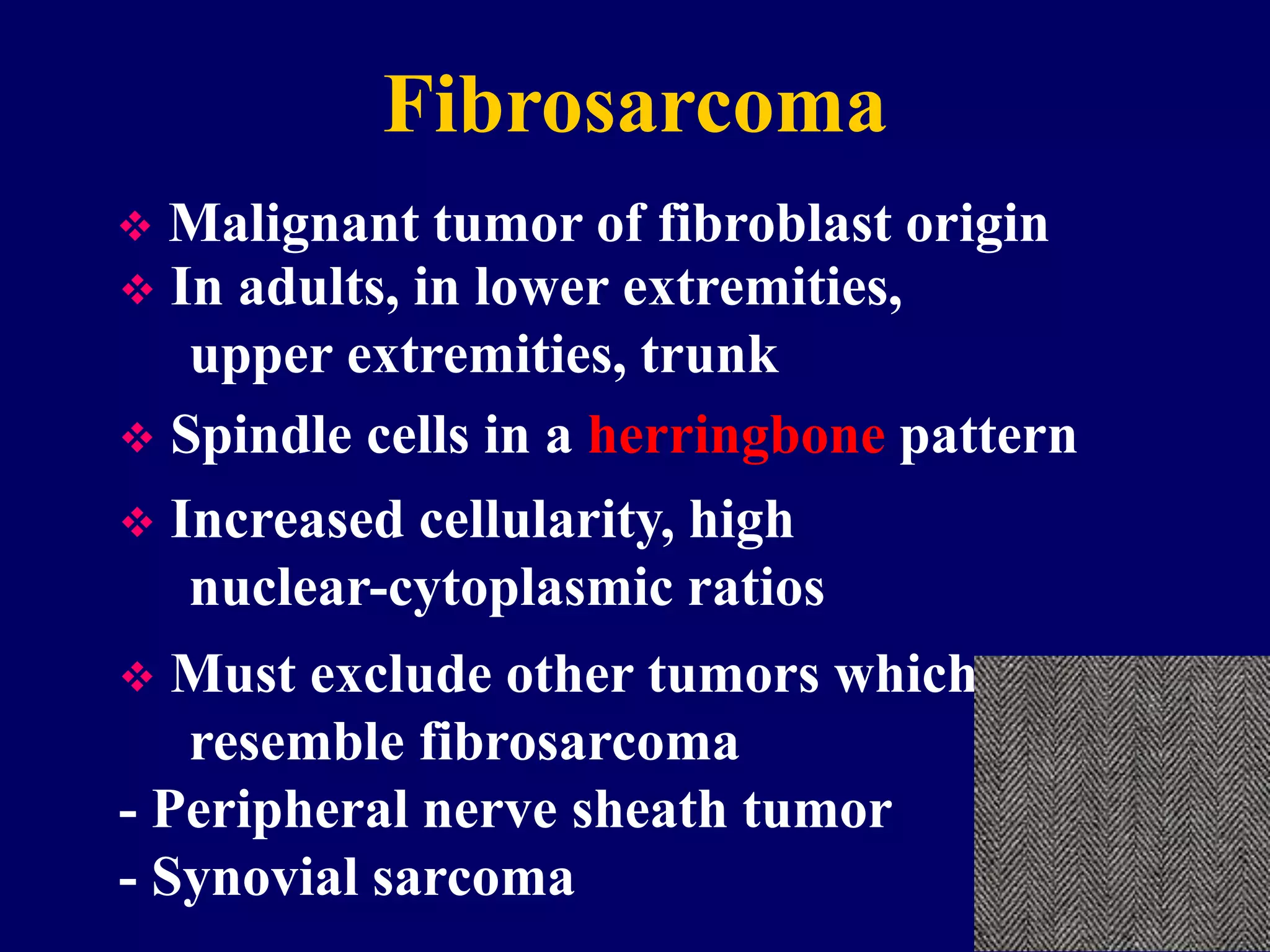 Soft tissue tumor.ppt