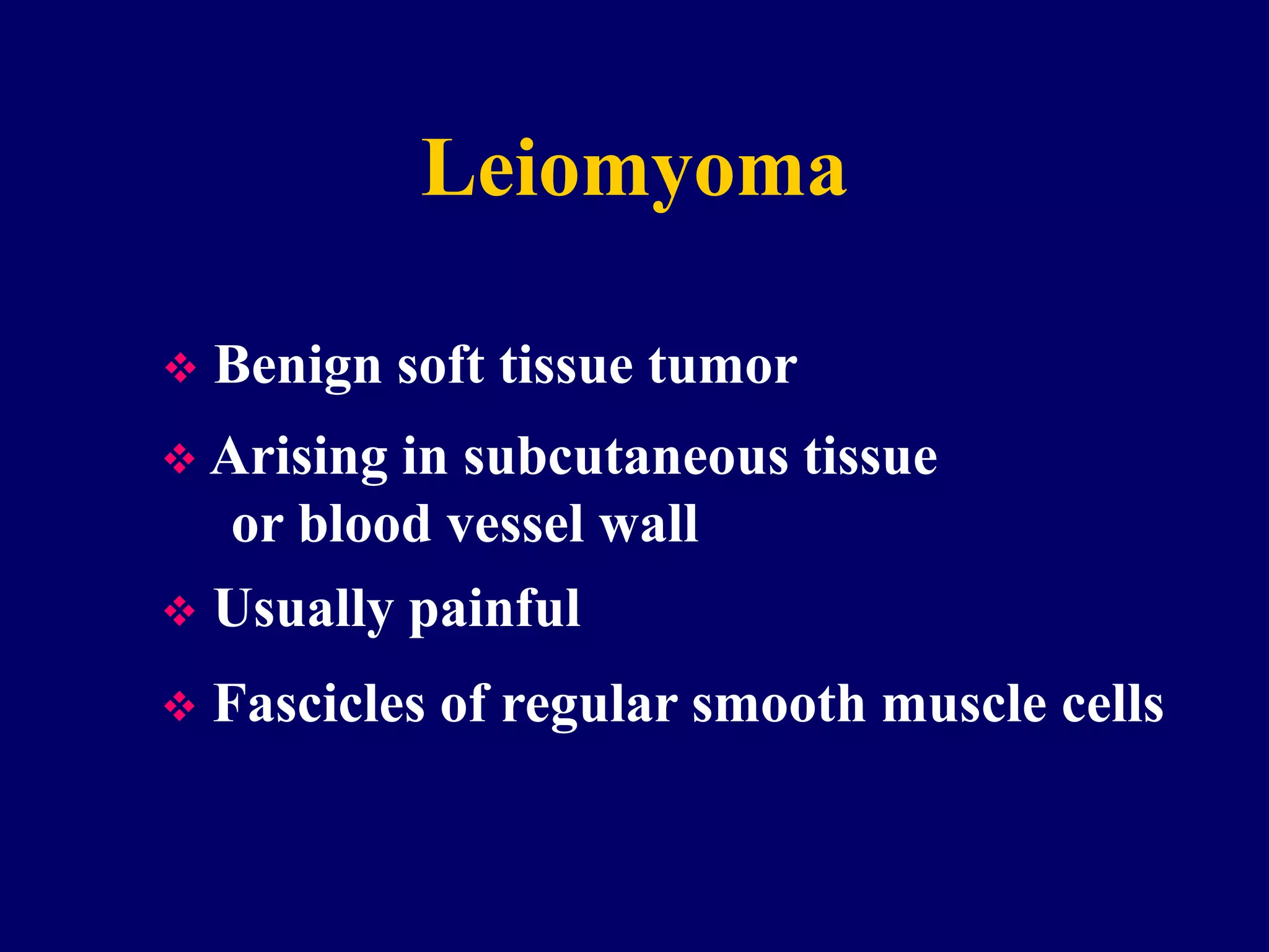 Soft tissue tumor.ppt
