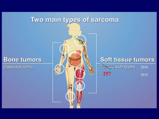 Soft tissue tumor.ppt | Cancer | Diseases and Conditions