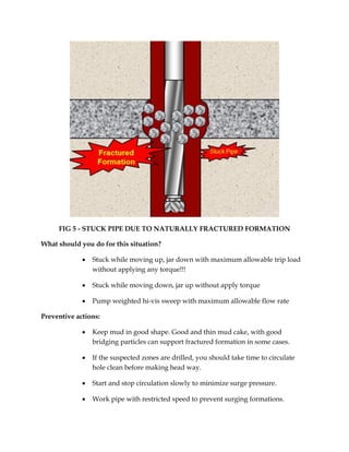 Stuck up– packing and bridging dd | PDF