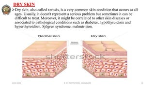 Stucture of skin relating to problems like dryskin, acne, pigmentation.pptx