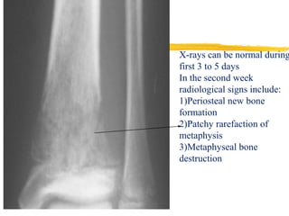 Bone and joint infections- Osteomyelitis | PPT