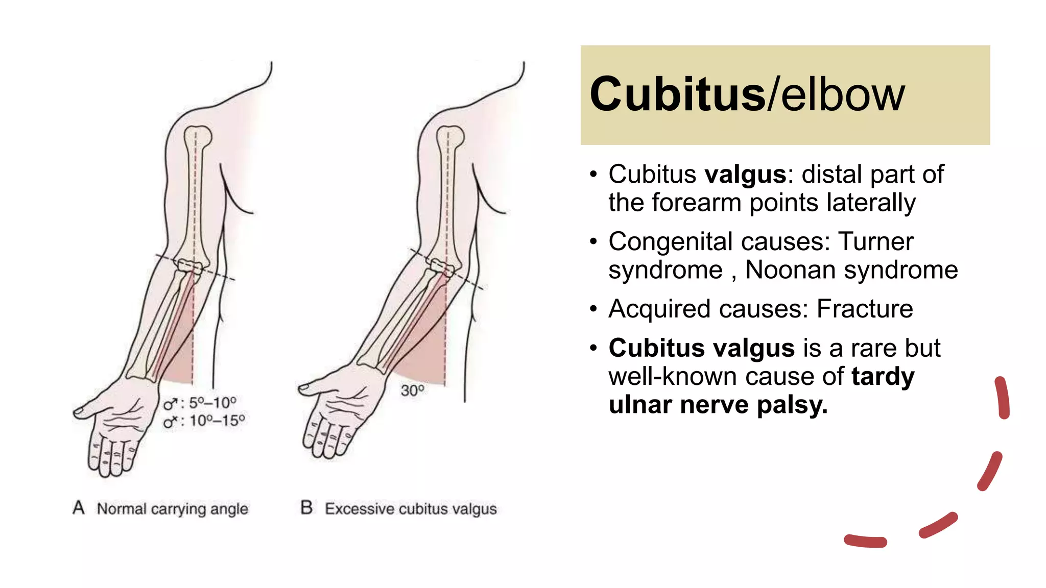 Student seminar valgus & varus | PPTX