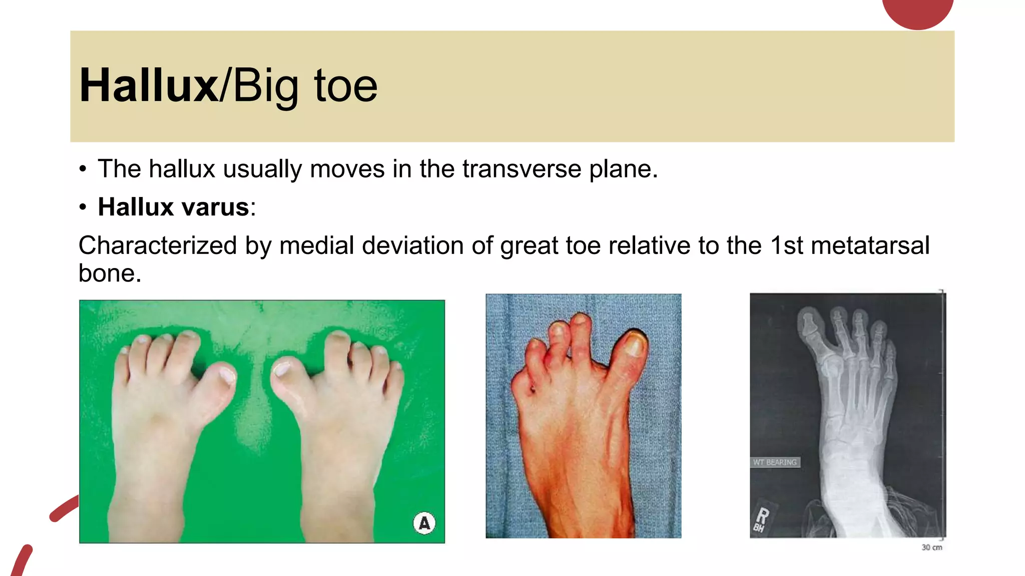 Student seminar valgus & varus | PPTX