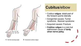 Student seminar valgus & varus | PPTX