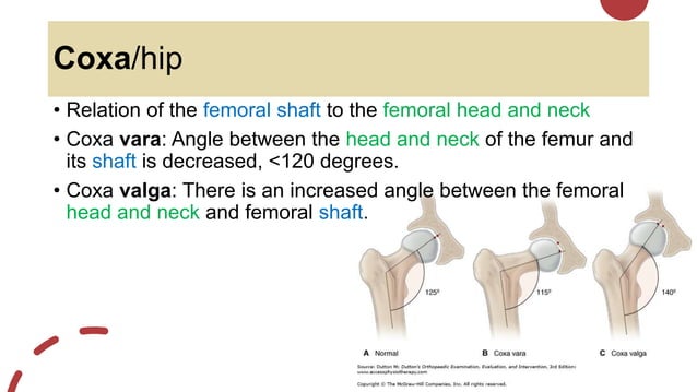Student seminar valgus & varus | PPTX | Death, Injury, or Military ...