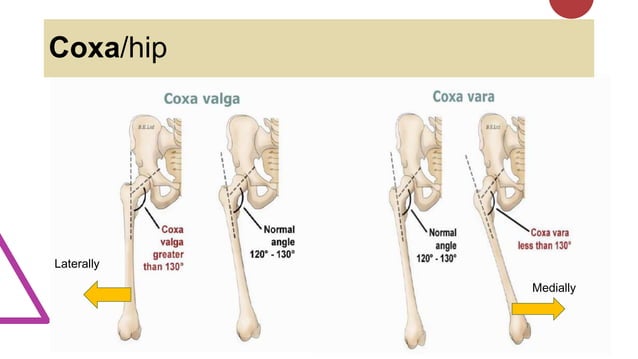 Student seminar valgus & varus | PPTX | Death, Injury, or Military ...