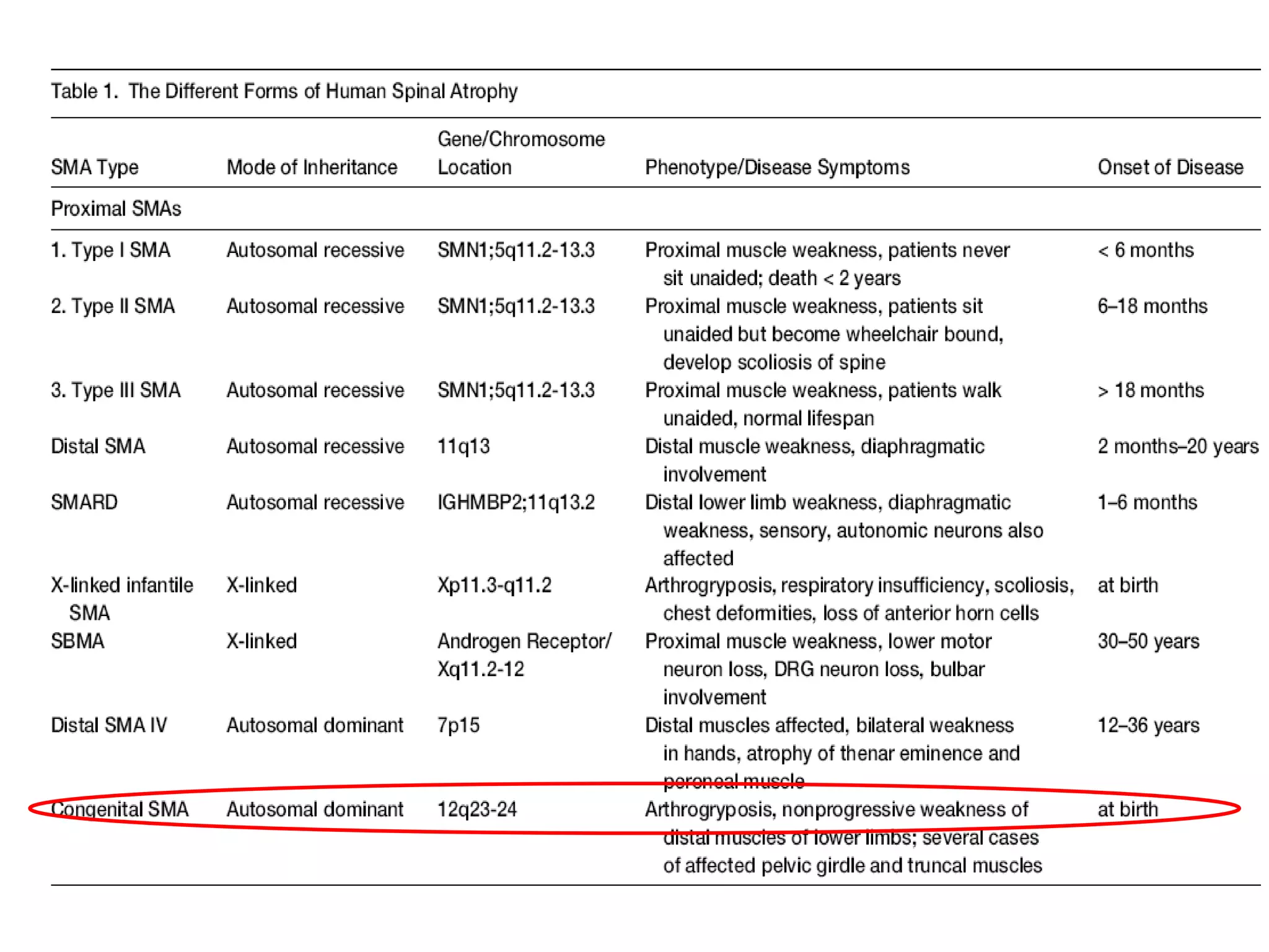 Spinal muscle atrophy SMA: make it easy | PPTX